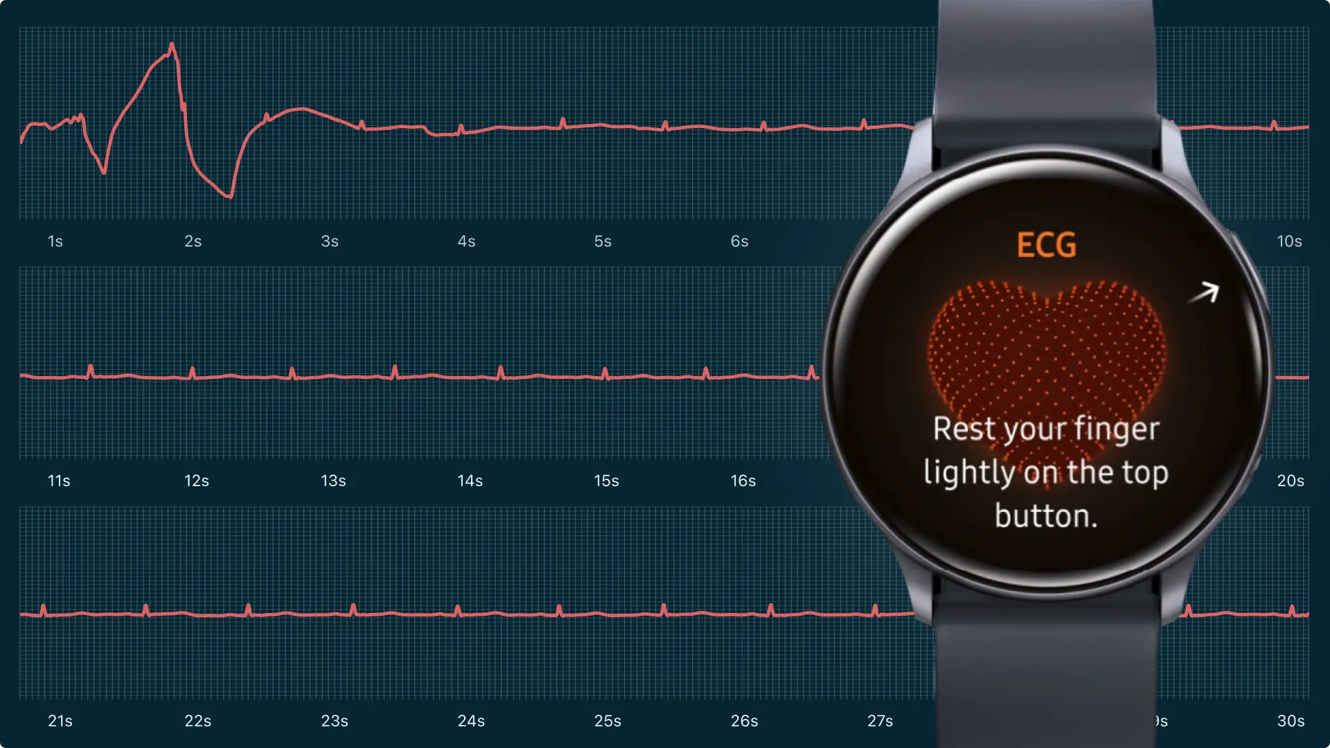 What Low Voltage Looks Like on Your Watch ECG | Qaly
